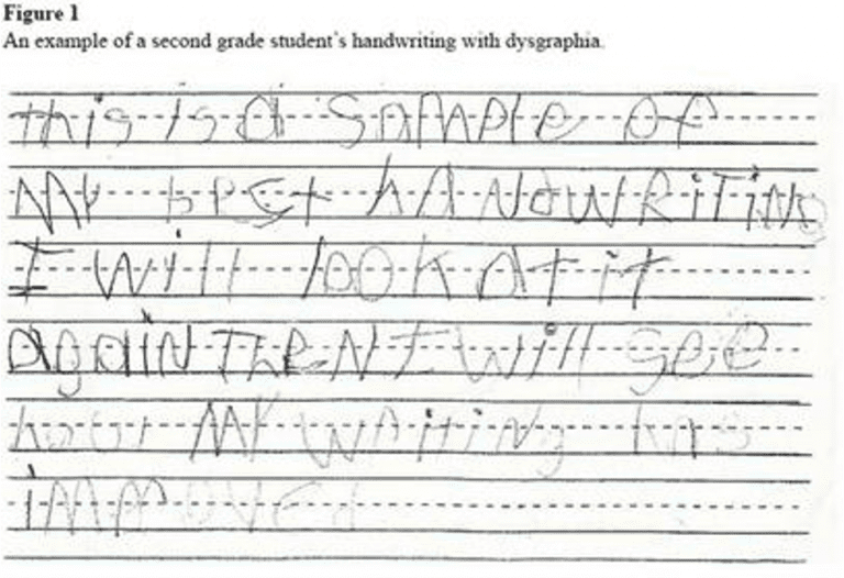 A Parent’s Guide to Dysgraphia: the Definition, Diagnosis and Treatment ...